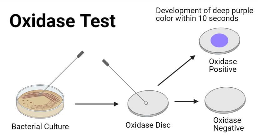  Filter Paper Disk Method Lab Ex 14 2022 11 12