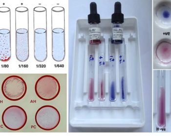 Immunology Archives - Microbiology Notes