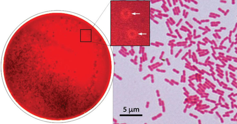 Biochemical Test of Kingella kingae