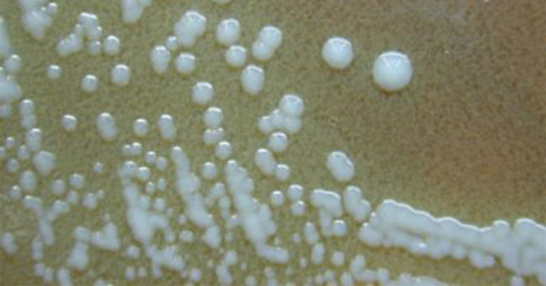 Cystine Glucose Blood Agar- Composition, Principle, Preparation ...