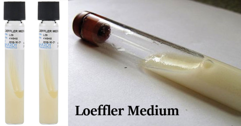 Loeffler Medium- Composition, Principle, Preparation, Results, Uses