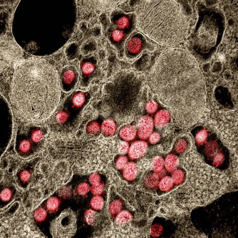 Transmission Electron Microscope (TEM)- Definition, Principle, Images
