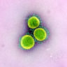 Electron microscopy (SEM and TEM) images of SARS-CoV-2