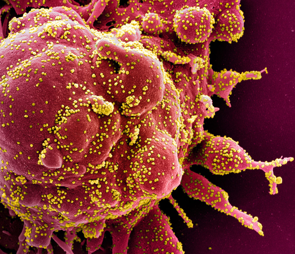 Electron microscopy (SEM and TEM) images of SARS-CoV-2