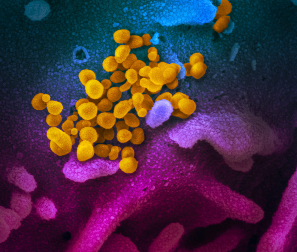 Electron microscopy (SEM and TEM) images of SARS-CoV-2