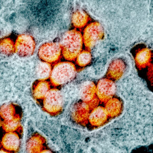 Electron microscopy (SEM and TEM) images of SARS-CoV-2