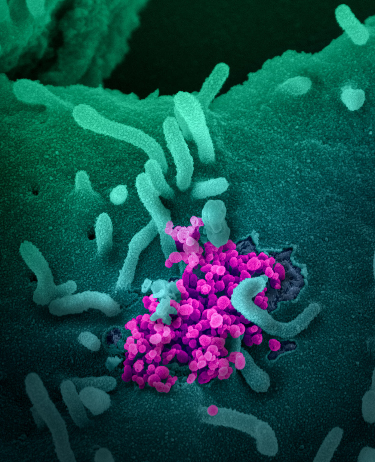 Electron microscopy (SEM and TEM) images of SARS-CoV-2