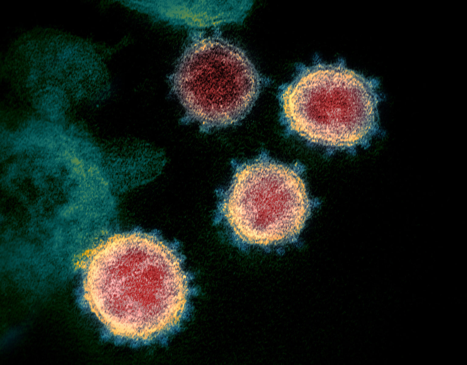 Electron microscopy (SEM and TEM) images of SARS-CoV-2
