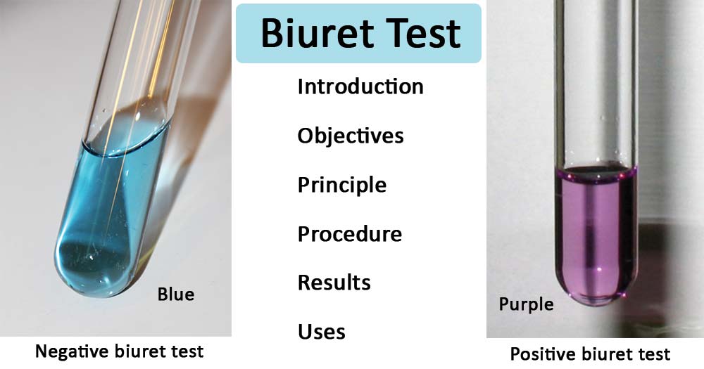 Biochemical Test Of Bacteria Notes Microbe Notes