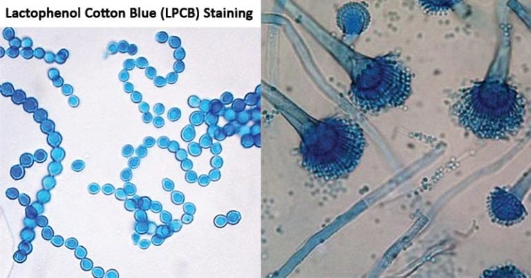 Staining Notes - Microbe Notes