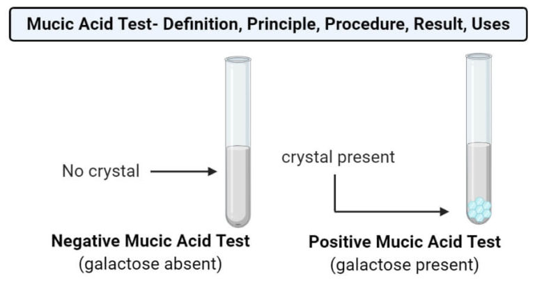 Mucic Acid Test- Definition, Principle, Procedure, Result, Uses