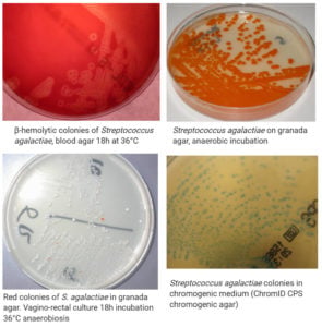Streptococcus agalactiae- An Overview - Microbe Notes