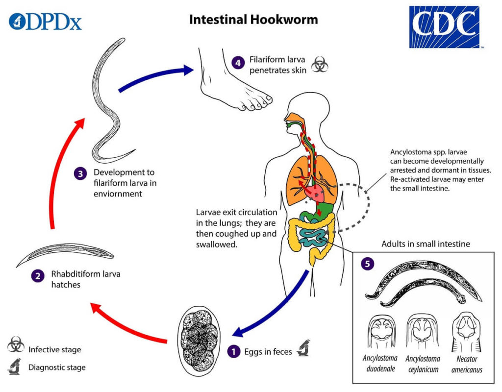 Ancylostoma duodenale- An Overview - Microbe Notes