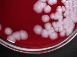 Bacillus anthracis- An Overview