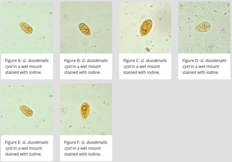 Giardia duodenalis (Giardia lamblia or Giardia intestinalis)