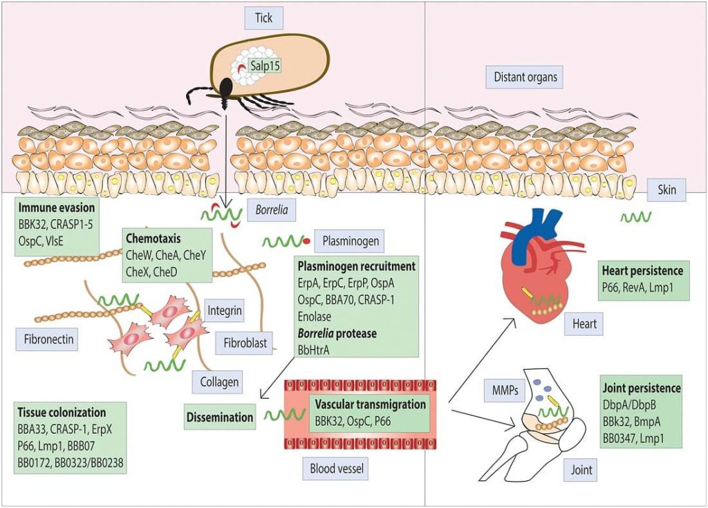 Borrelia burgdorferi (Lyme Disease): An Overview