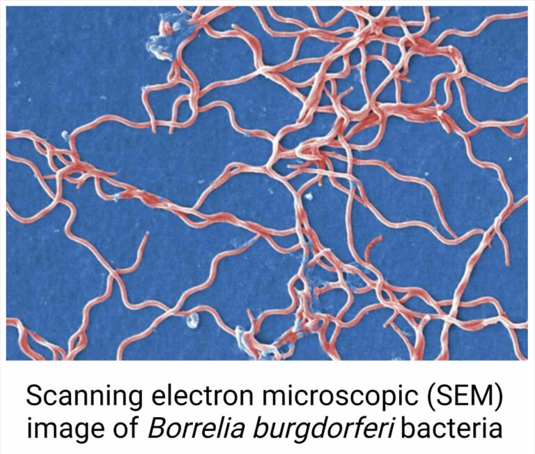 Borrelia burgdorferi (Lyme Disease)- An Overview