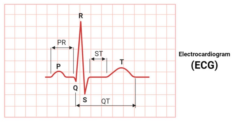 Electrocardiogram (ECG): Understanding Heart's Electrical Activity Electrocardiogram (ECG): Understanding Heart's Electrical Activity