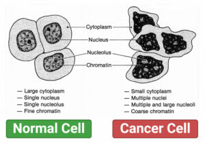Cancer Cells: Definition, Morphology, Types, Development