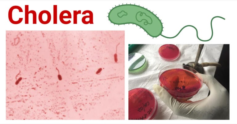 Cholera: A-Level Biology Revision Notes