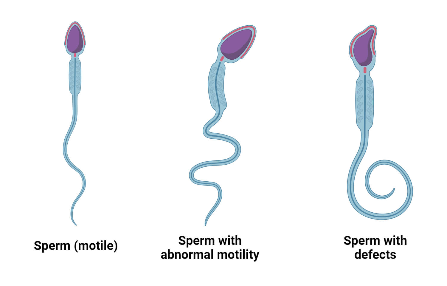 Sperm Cell Unraveled Anatomy Functions Key Diseases Sperm Cell Unraveled Anatomy Functions Key Diseases
