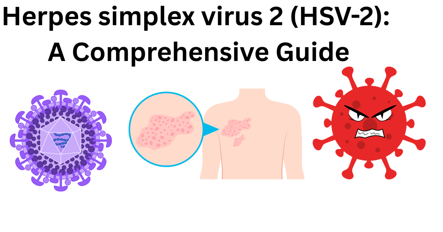 Herpes Simplex Virus 2 (HSV-2): A Comprehensive Guide