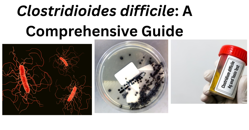 Clostridioides difficile: A Comprehensive Guide