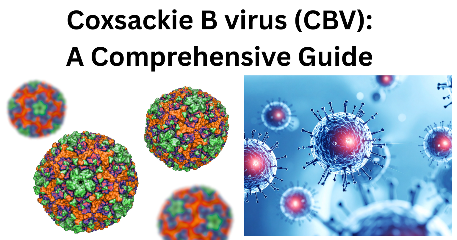 Coxsackie B virus (CBV): A Comprehensive Guide