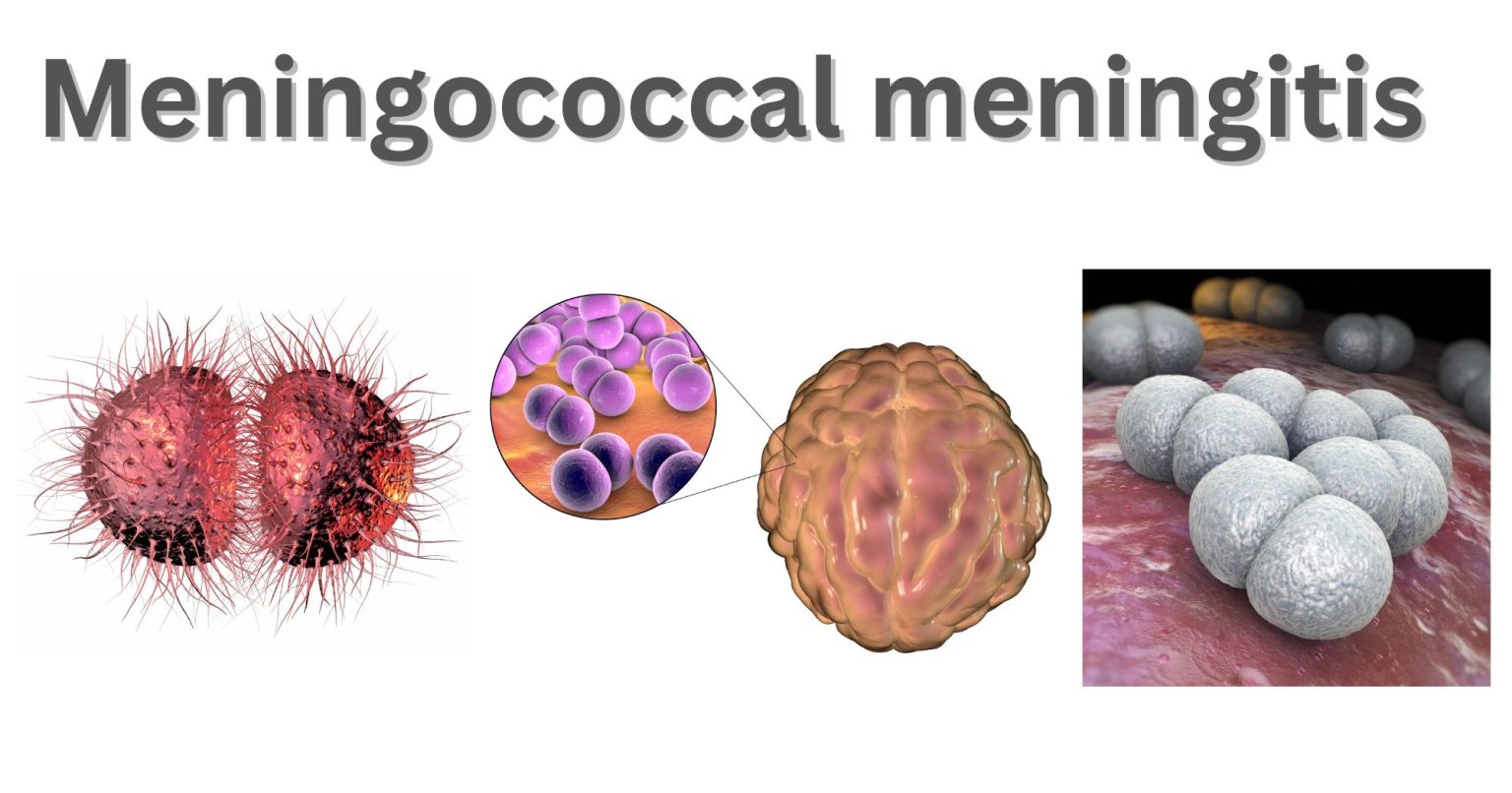 Neisseria meningitidis and Meningococcal Meningitis