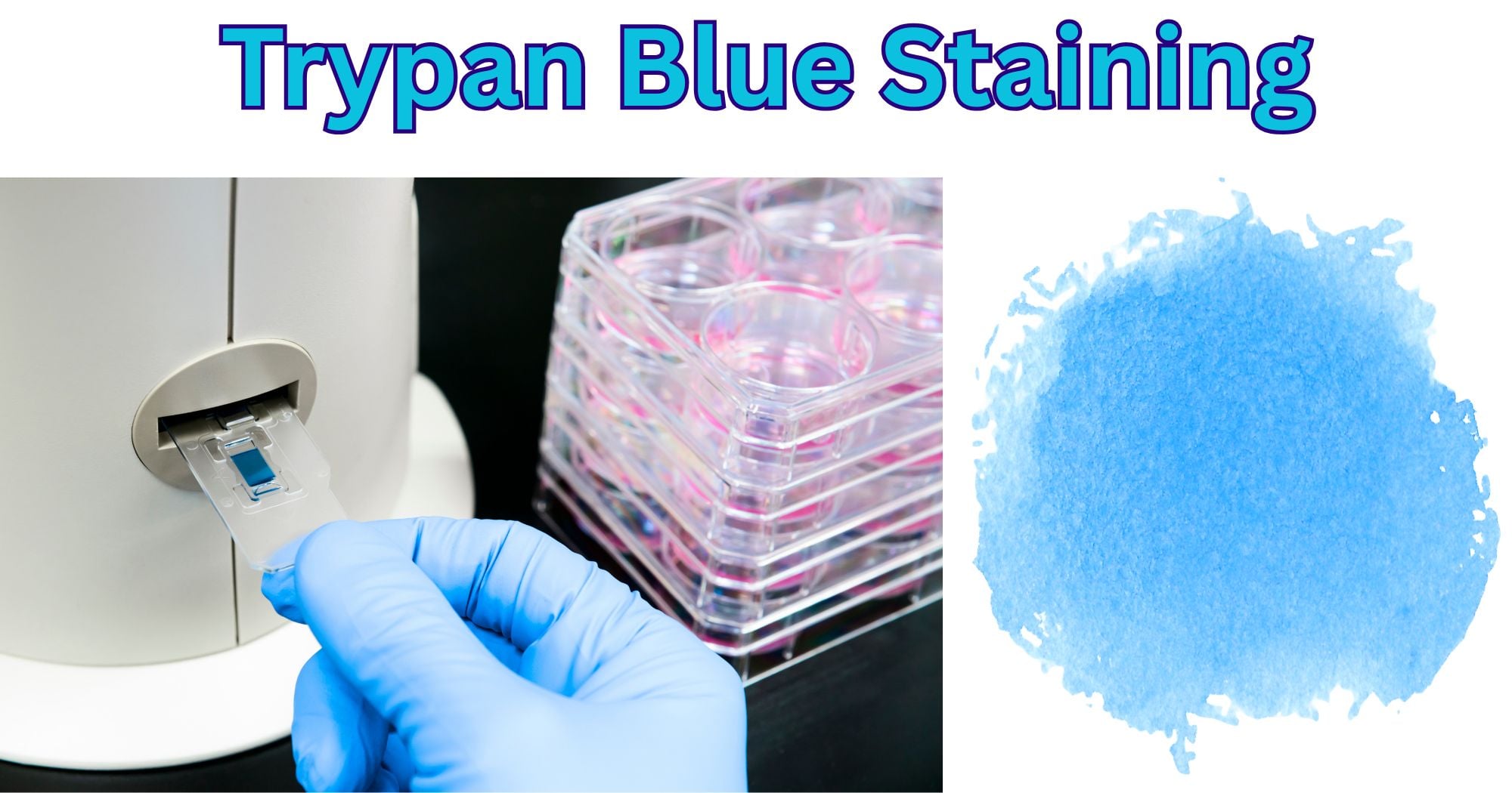 Trypan Blue Staining or Cell Viability Test