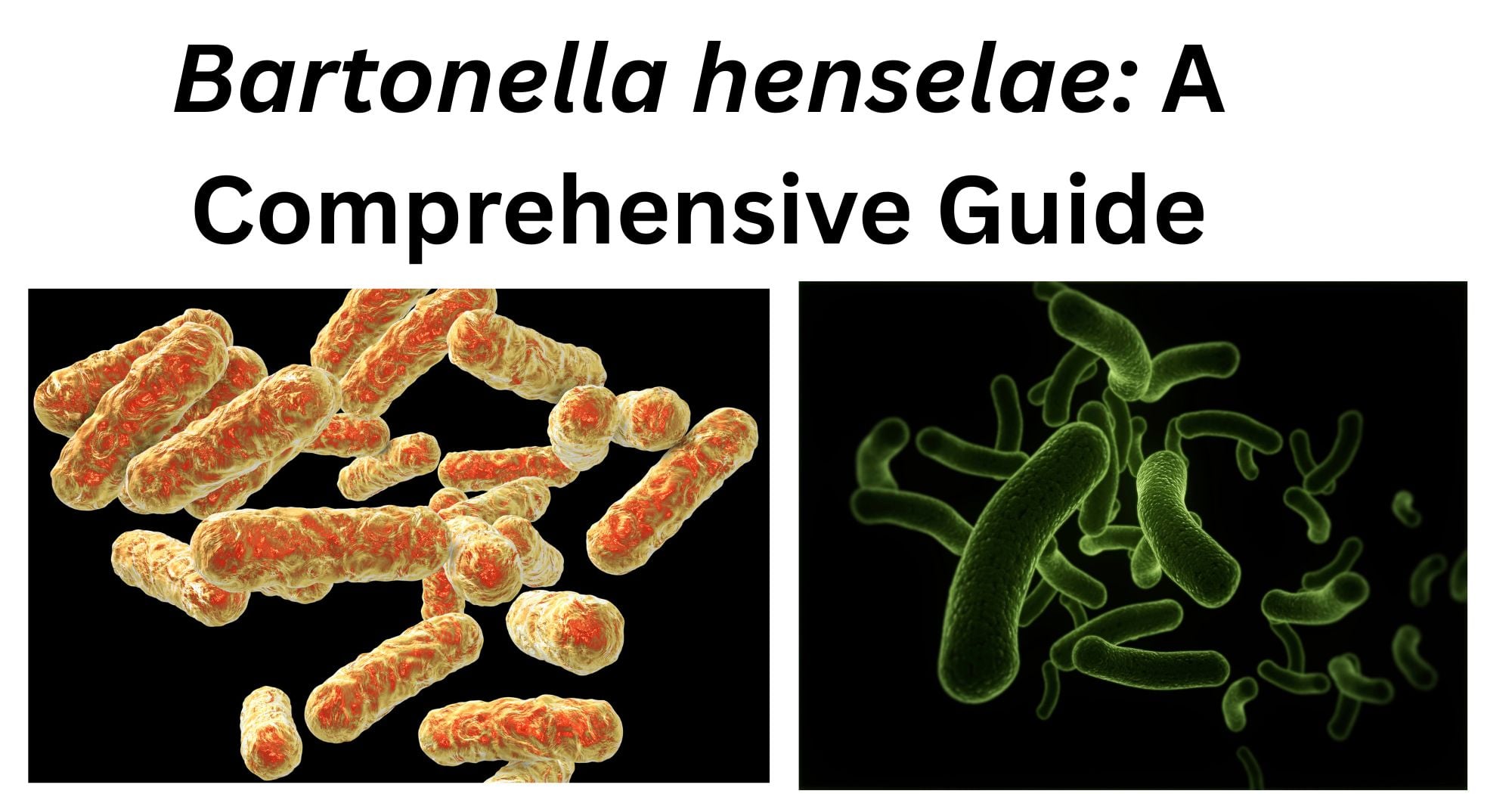 Bartonella henselae: A Comprehensive Guide