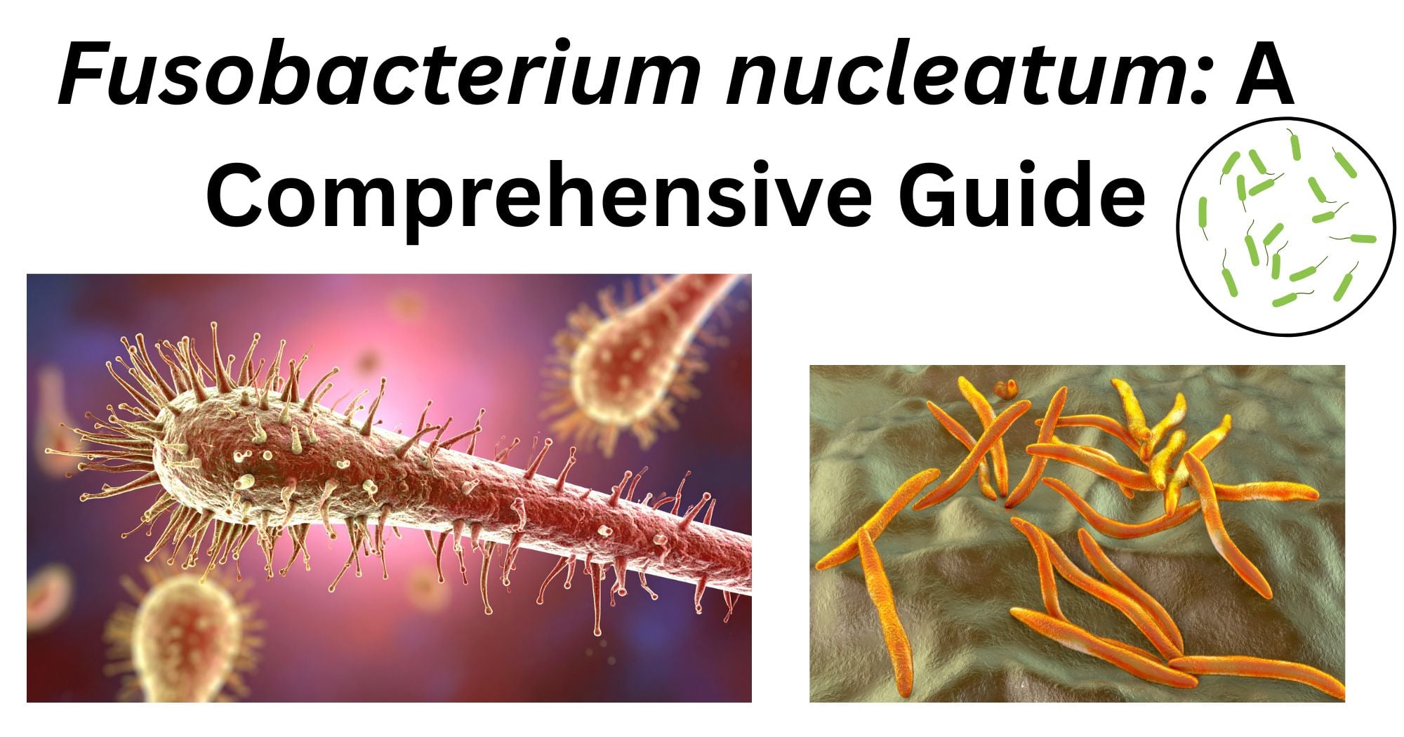 Fusobacterium nucleatum: A Comprehensive Guide