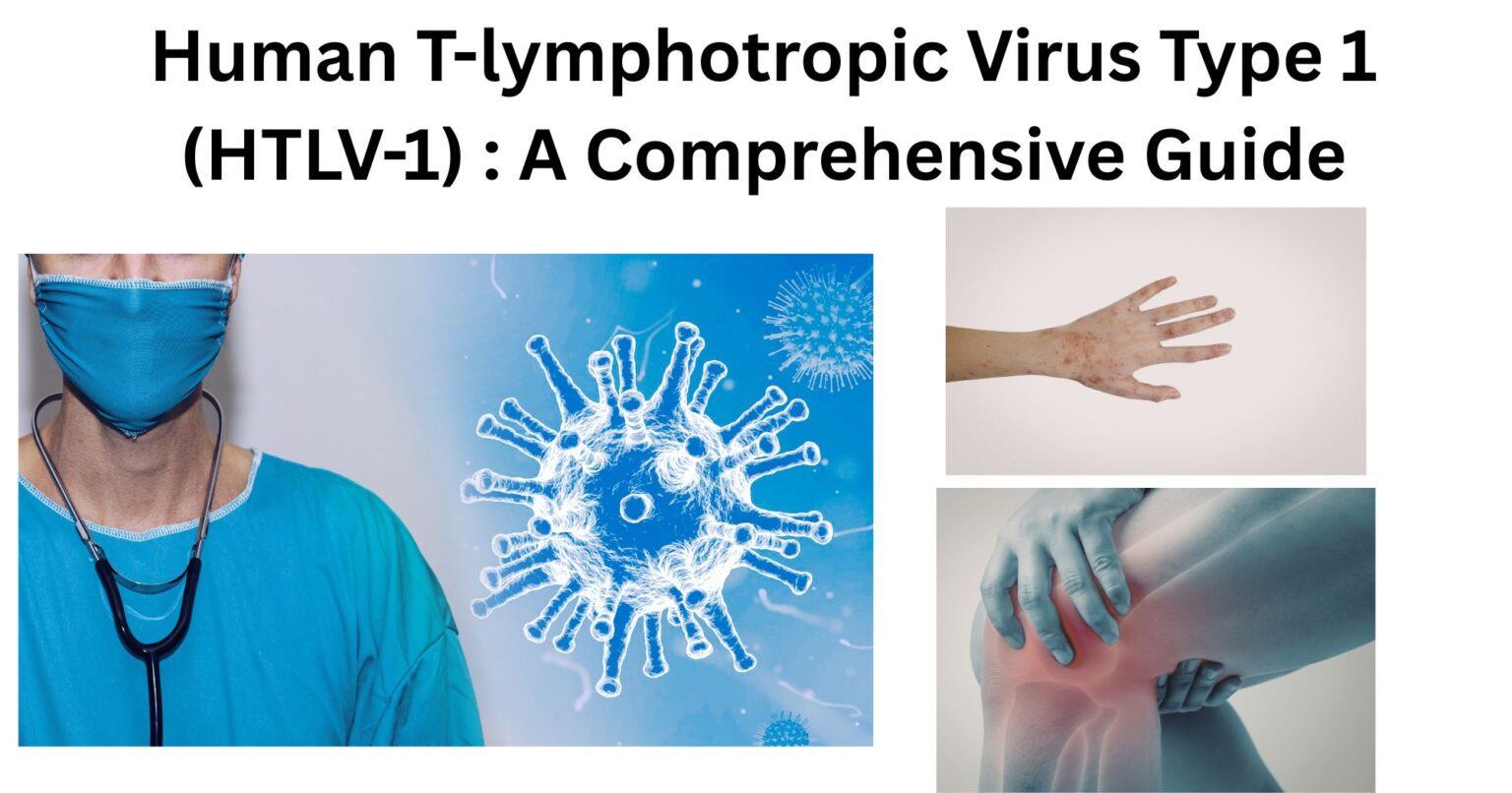 Human T-lymphotropic virus type 1 (HTLV-1): An Overview