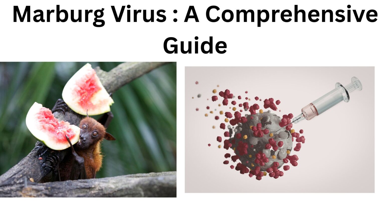 Marburg Virus: A Comprehensive Guide