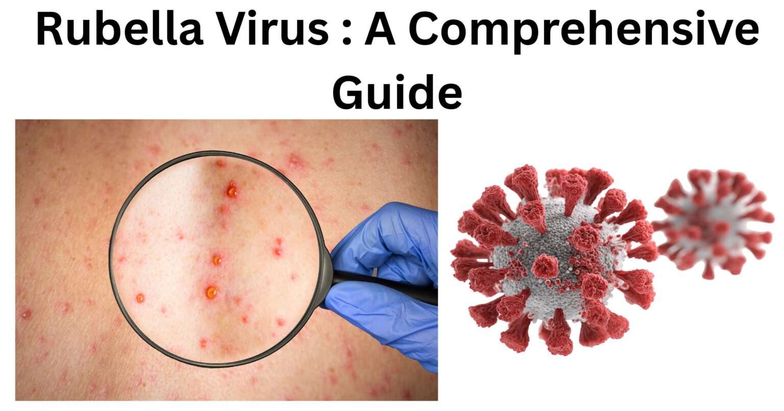 Rubella Virus: A Comprehensive Guide