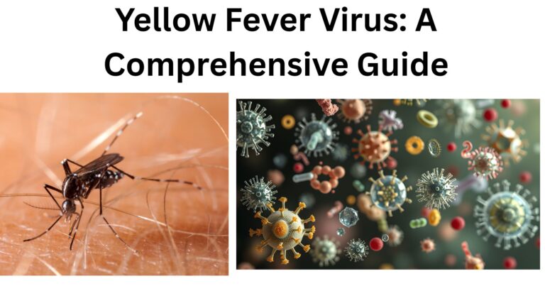 Yellow Fever Virus: A Comprehensive Guide
