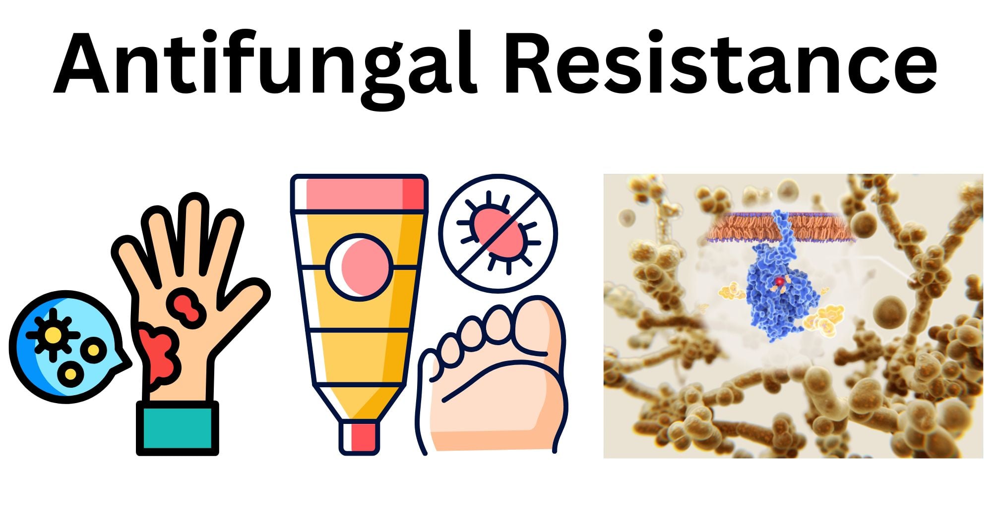 Antifungal Resistance: Pathogens, Mechanisms, Factors, Impact